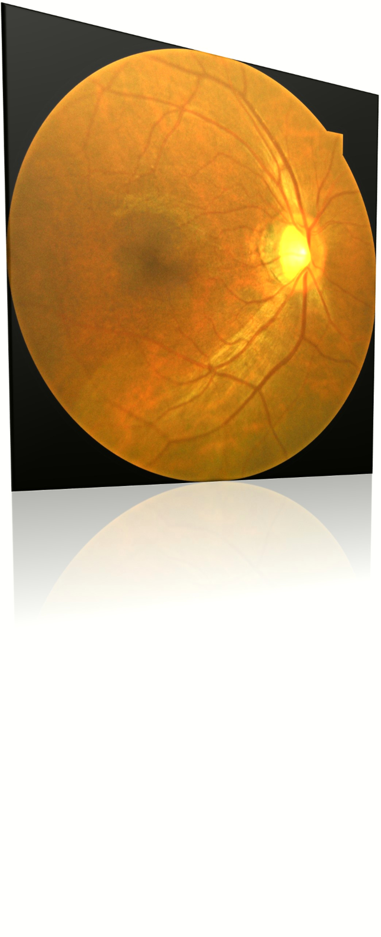 SYSEYE KESTREL 300 – PORTABLE FUNDUS CAMERA - OptoHellas