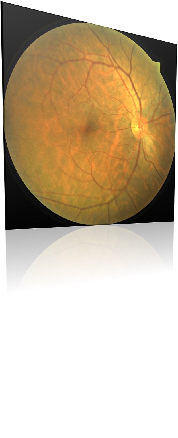 SYSEYE KESTREL 300 – PORTABLE FUNDUS CAMERA - OptoHellas